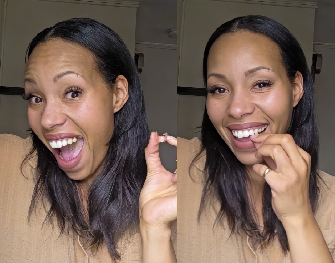 Replace Your Missing Teeth At-Home | ResetSmile