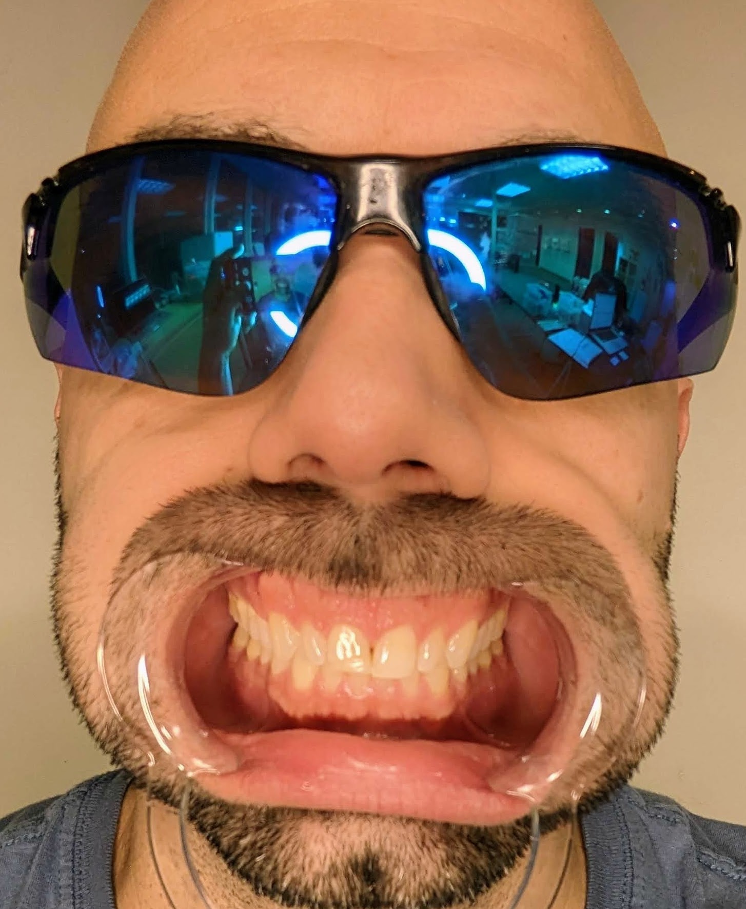 Upload Your Photos | ResetSmile