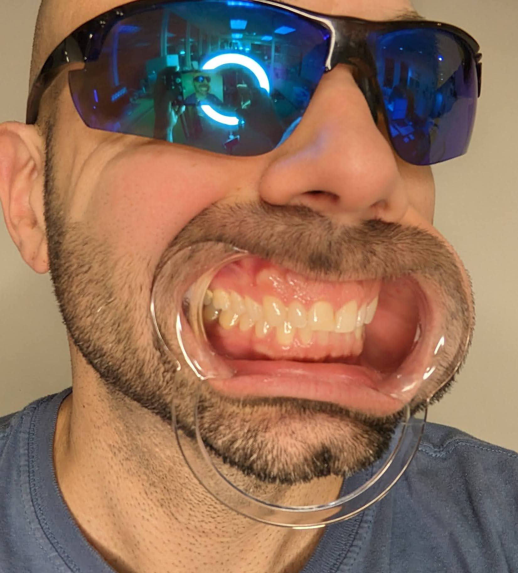 Upload Your Photos | ResetSmile