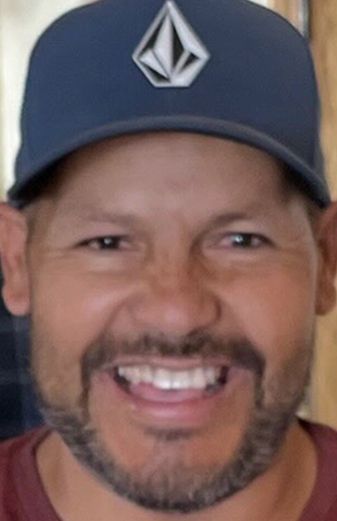 Replace Your Missing Teeth At-Home | ResetSmile